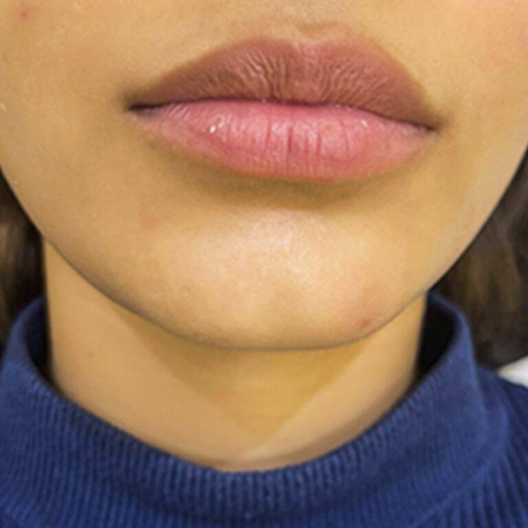 Aesthetics Lab: HydraFacial, Laser, Carbon Peel & More