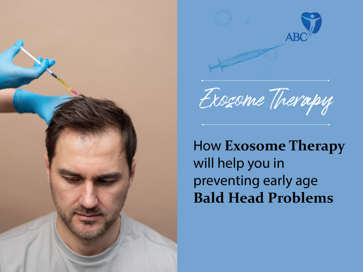 aesthetics lab : Exosomes For Hair Fall Solution In Lahore – Get ...